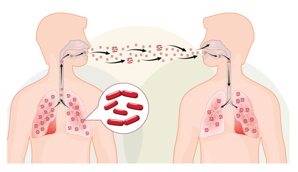 What is Tubercolosis, and is it easily contagious?